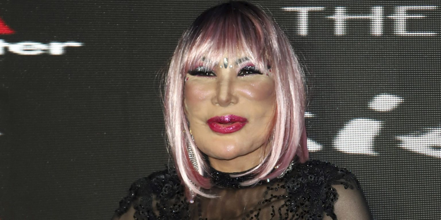Whats Wrong With Lyn May Face Plastic Surgery Daughters Wiki Net Worth Post
